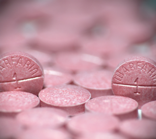 Deep Vein Thrombosis (DVT) Treatments - Pedes Orange County